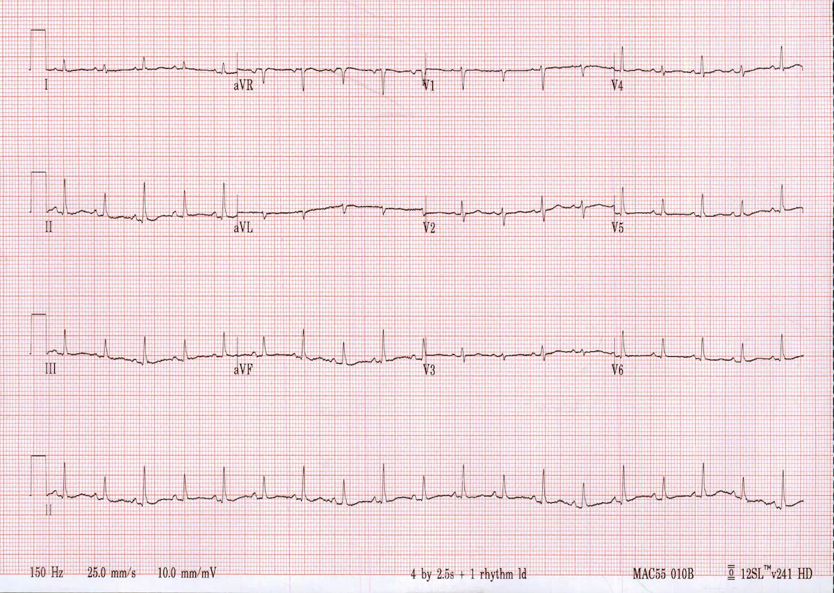 A swinging heart in cardiac tamponade - The New Zealand Medical Journal