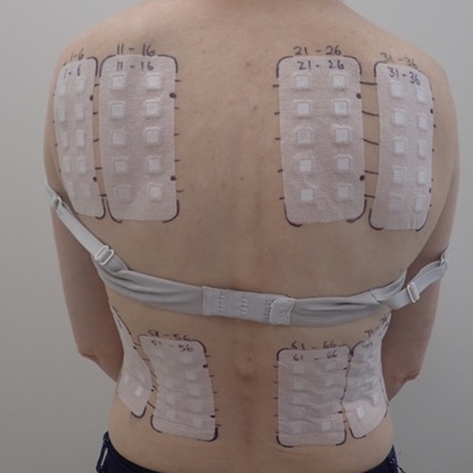 Patch testing to plants: sensitisation associated with exposure to ...