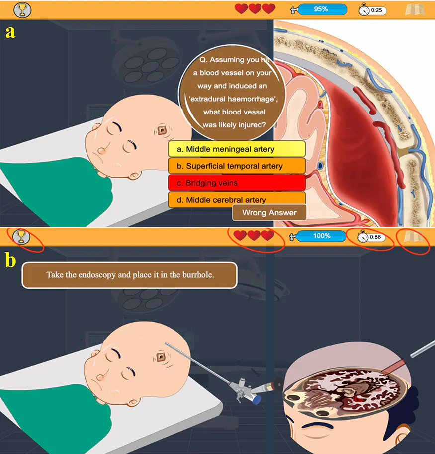 Clinical anatomy through gamification: a learning journey - The New ...